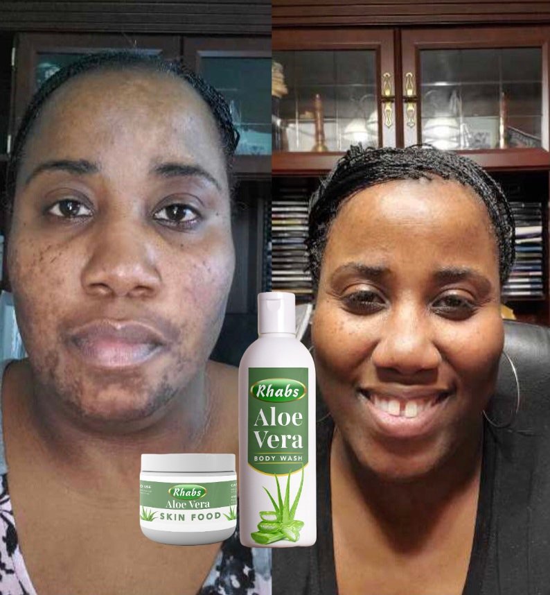 Rhabs Aloe Vera Skin Rep.. in Ghana Best Sale Price: Upfrica GH